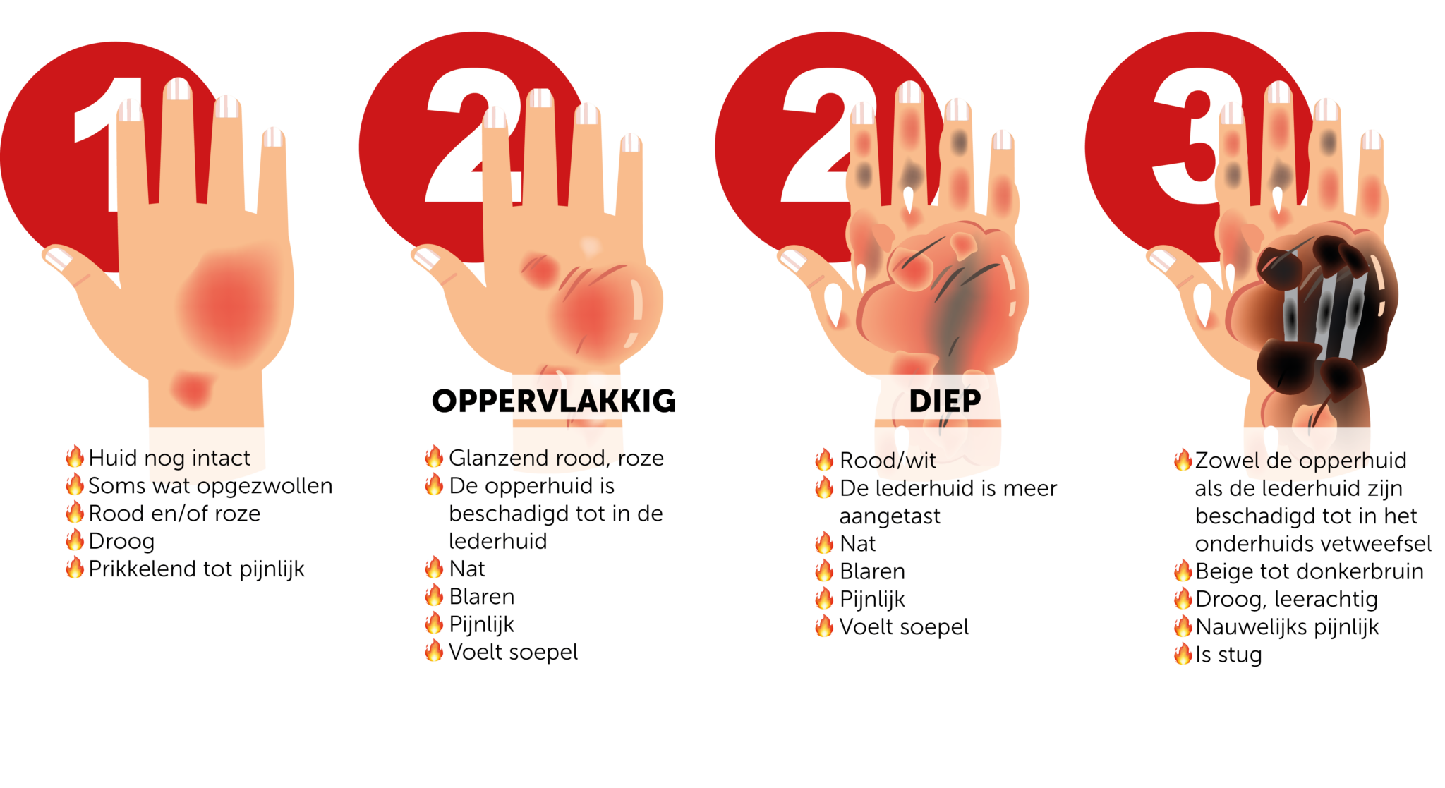 brandwonden - Kinderbrandwondenfonds